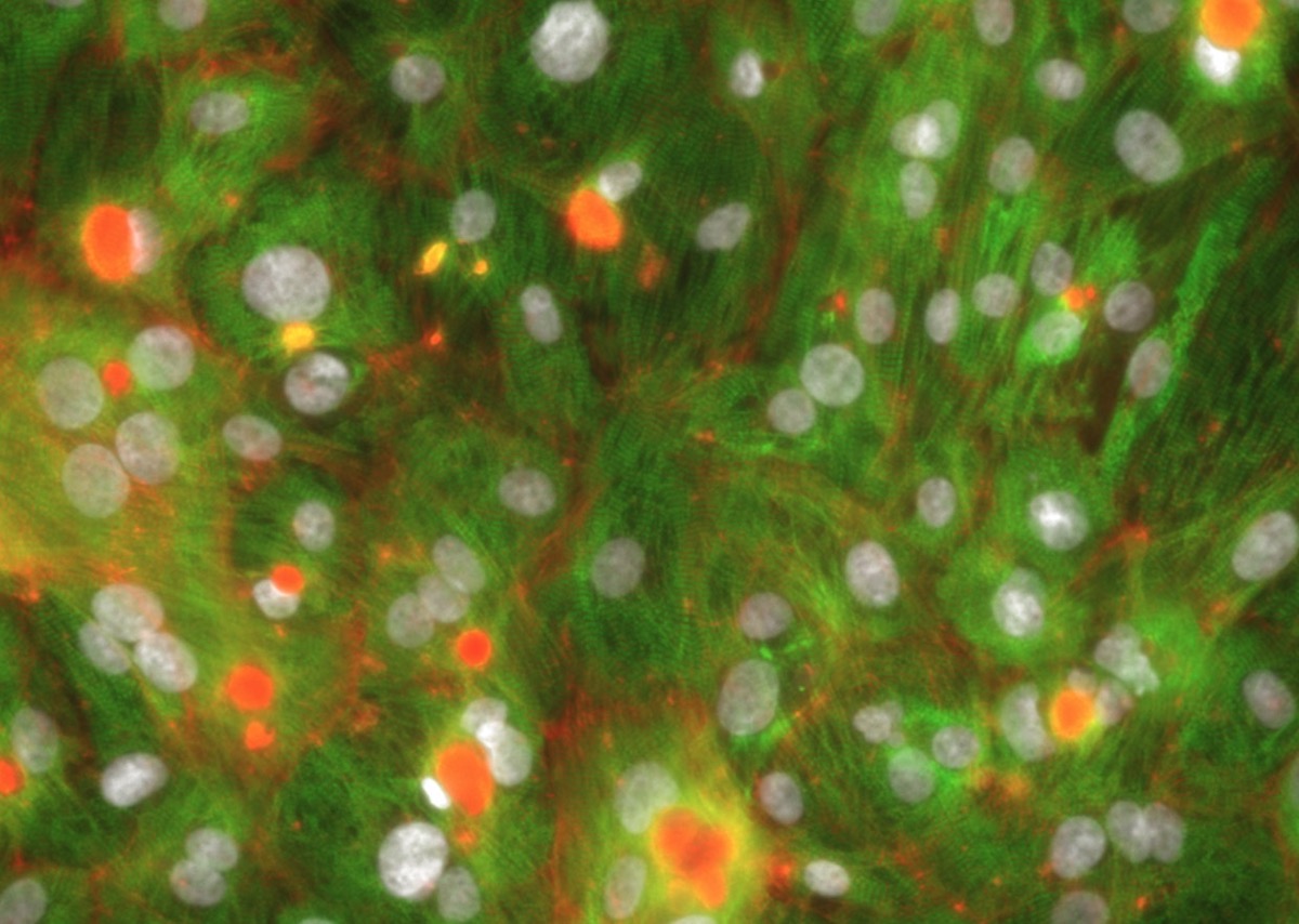 Tenaya Therapeutics Raises $92 Million In Funding To Deliver Curative ...