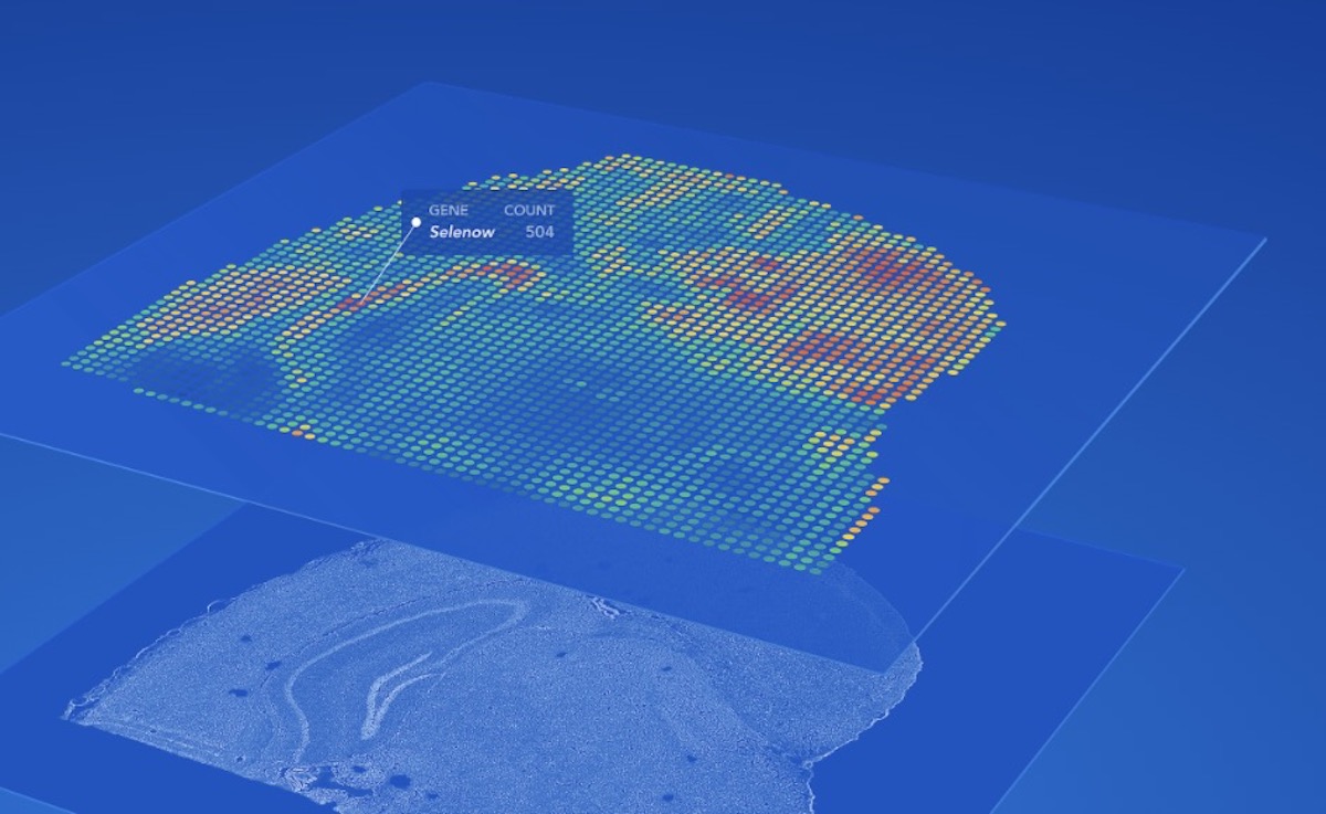 Why 10X Genomics (TXG) Acquired ReadCoor And CartaNA AB