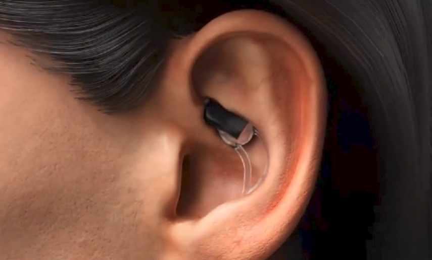 STAT Health: $5.1 Million Secured To Develop In-Ear Wearable For ...