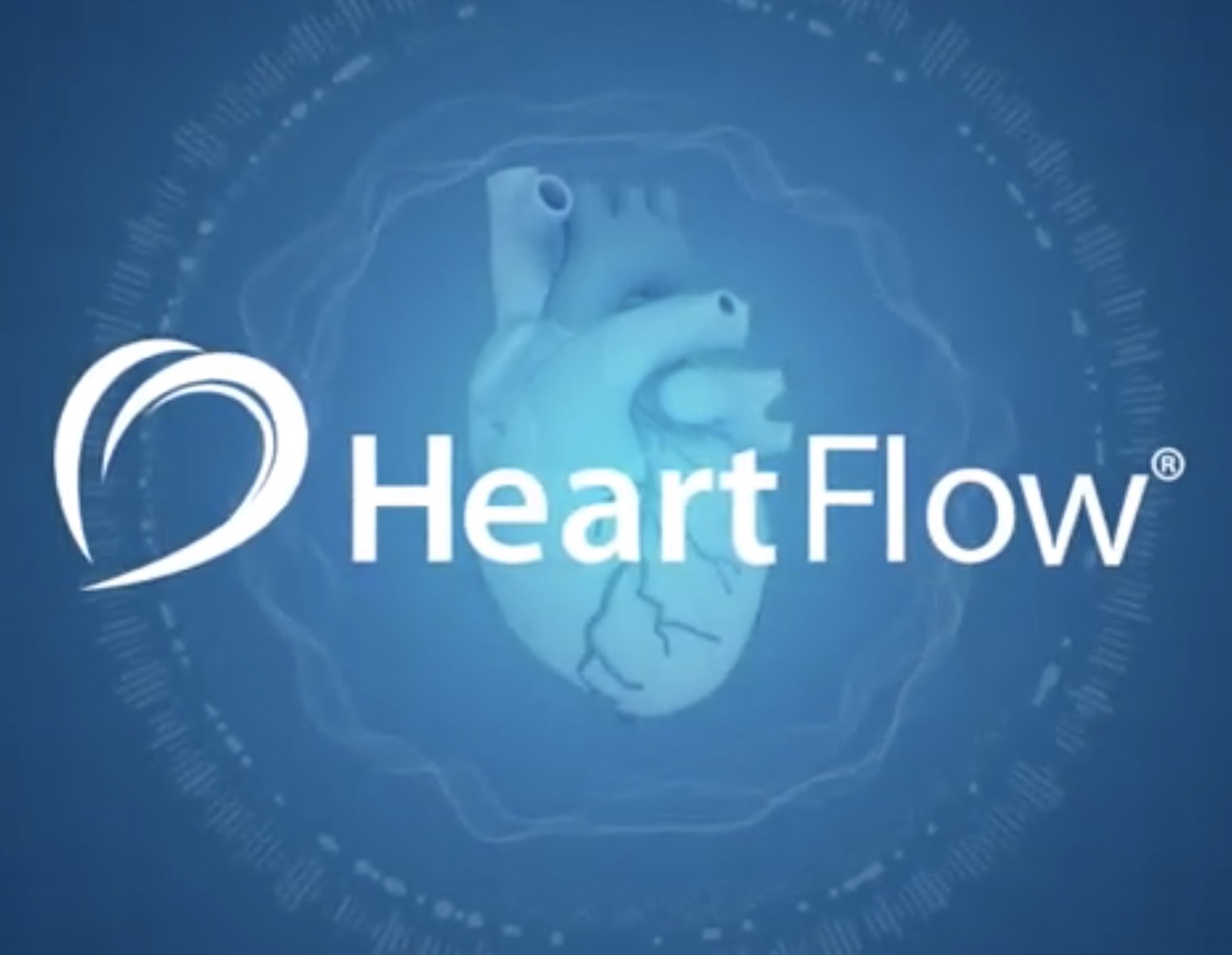 Precision Heart Care Company HeartFlow Raises $215 Million