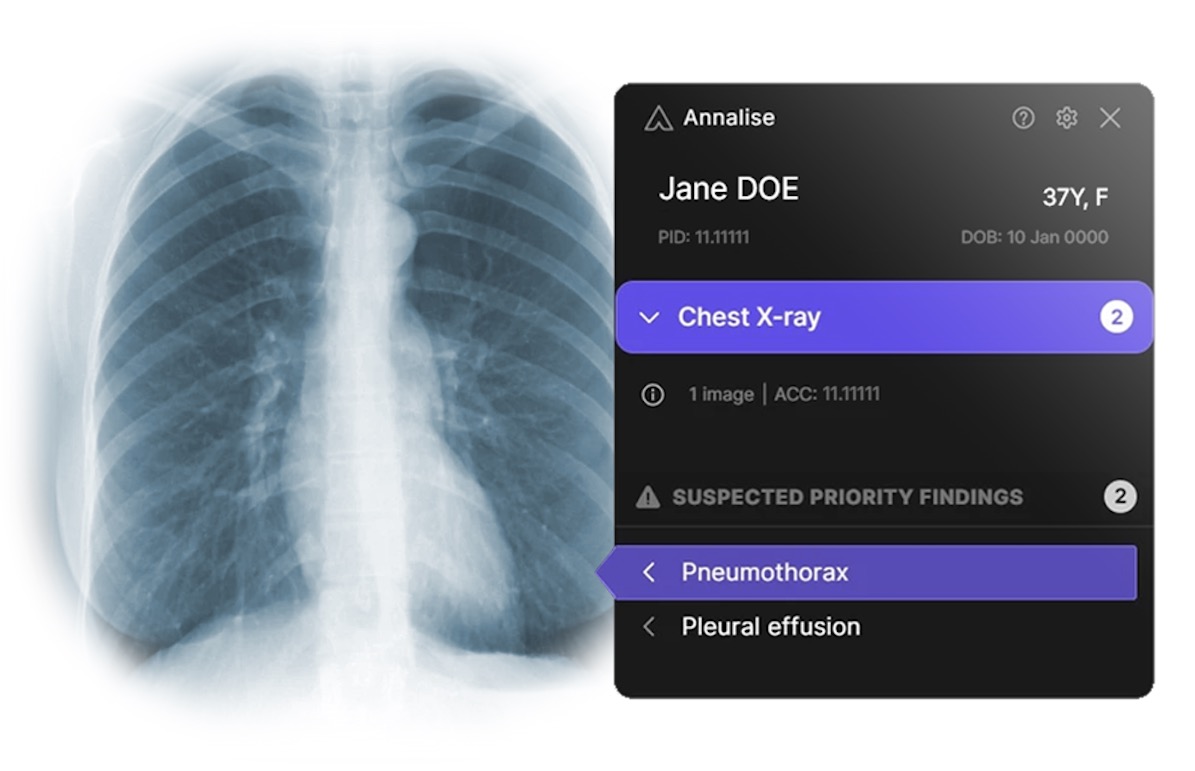 Annalise: The Story Behind This Leading Developer Of Advanced AI ...